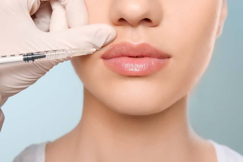 Dermal Fillers in Eltham London | AR Smiles London