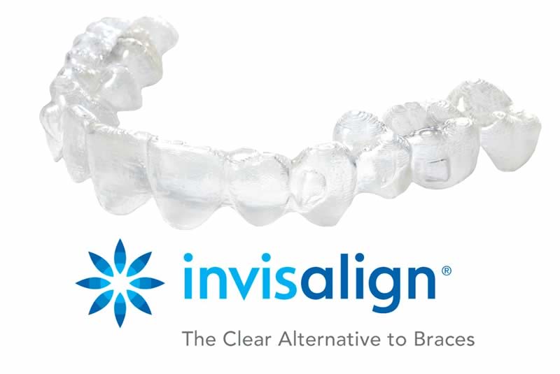 Invisalign In Eltham | Blackheath | SouthEast london
