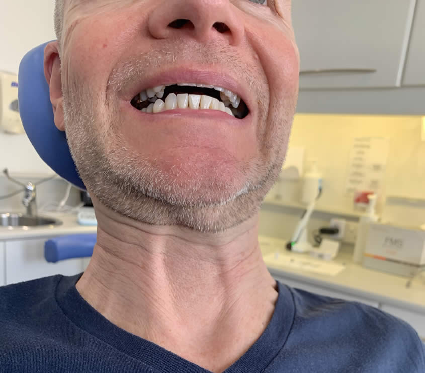 Nose and Neck - AR Smiles